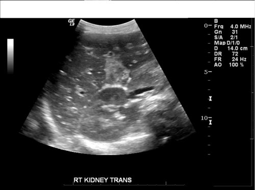 Liver Imaging for Gastroenterologists – Matt Stammers' Blog